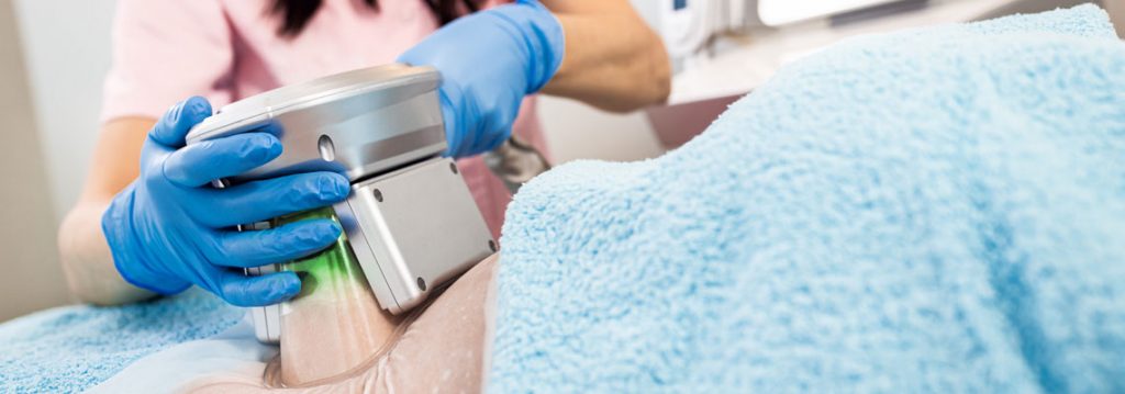 Choisir un spécialiste en cryolipolyse des genoux à Paris